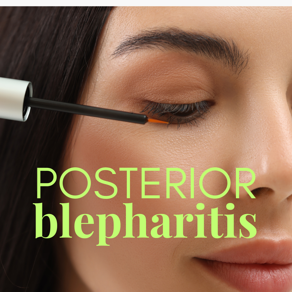Can Eyelash Serum Cause Posterior Blepharitis? Tips to Protect Your Ey ...